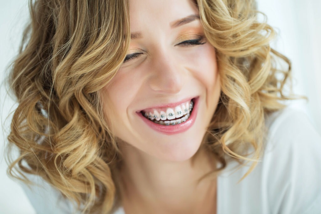 Which Orthodontic Option Is Best for You? | Adelaide Orthodontics